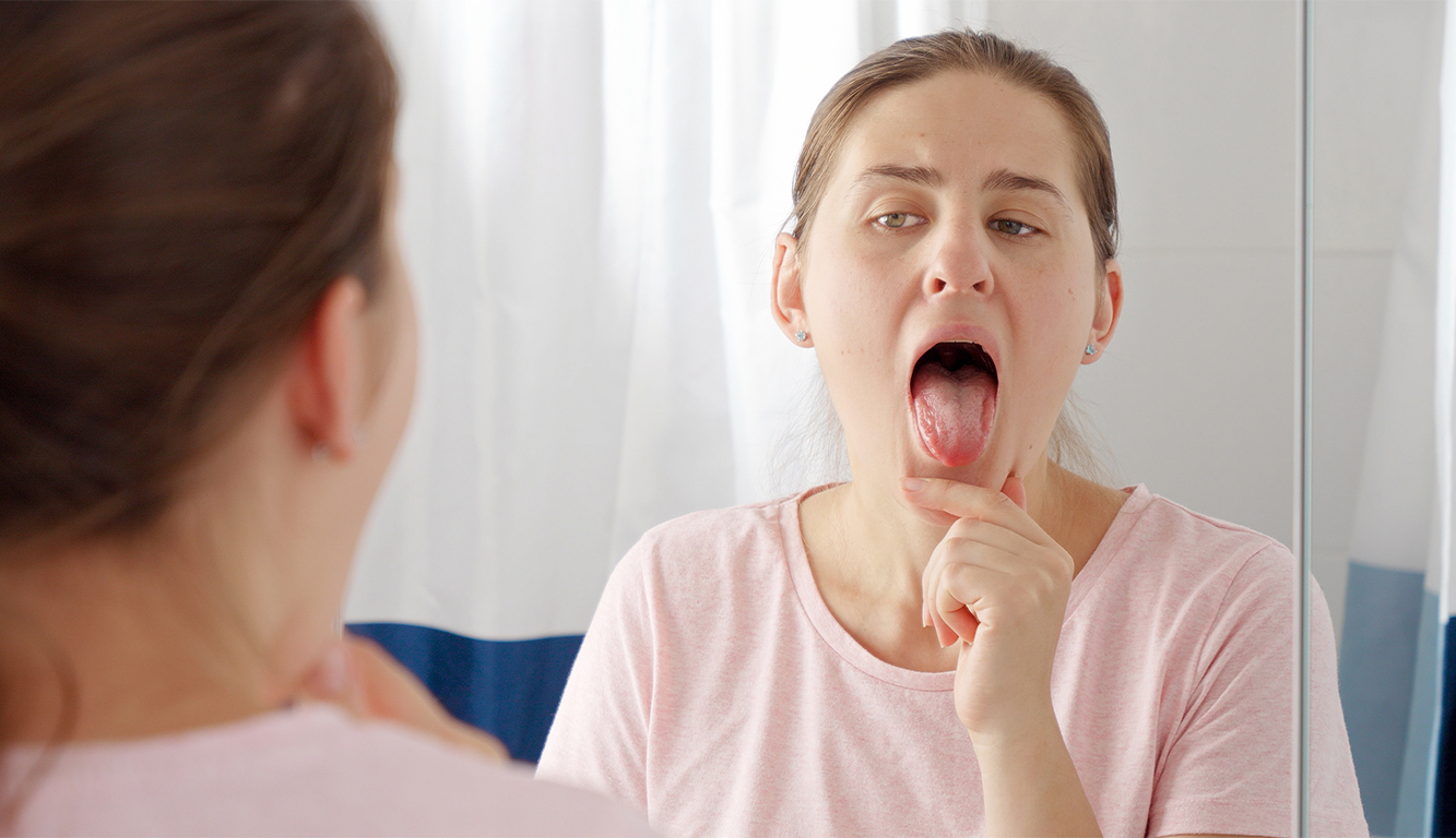 Saburra lingual: saiba como acabar com a língua saburrosa